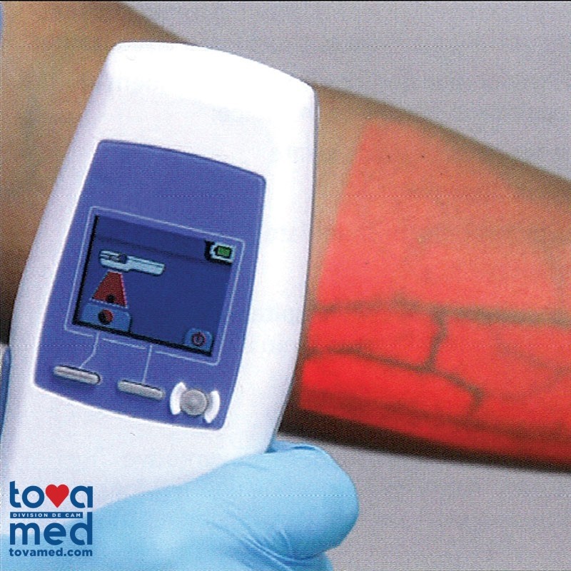 VEIN VIEWING MEDICAL EQUIPMENT