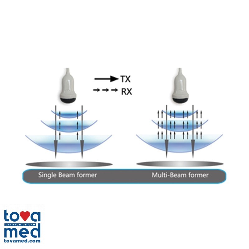 CHISON I3 ULTRASOUND, 19” LCD, 4 probe connectors, 4D technologies